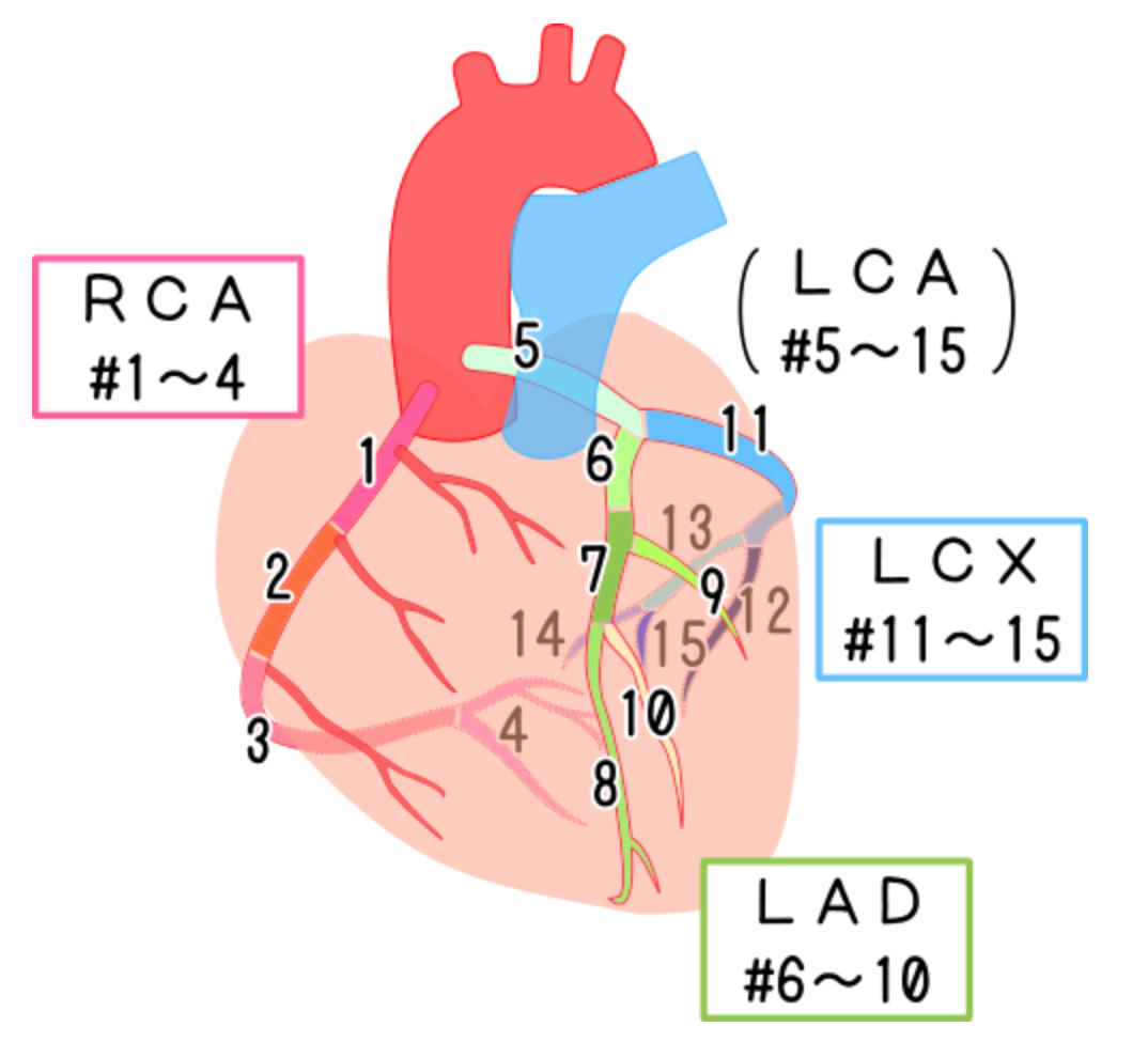 【循環器総論-15】左心カテーテル検査 | 心臓血管外科 ️美容外科